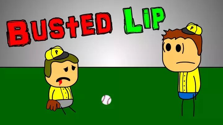 Busted Lip
