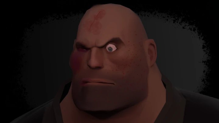 Heavy TF2 Needs Medical Attention